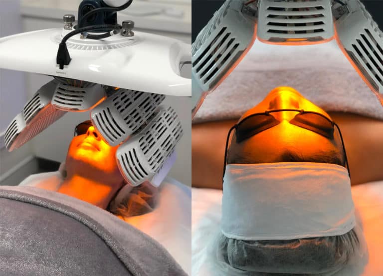 Healite II (LED) Light Therapy Sydney | Infinity Skin Clinic