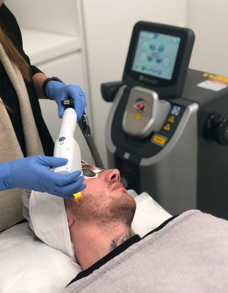 ETHEREA IPL-Sq® Photo Rejuvenation | Infinity Skin Clinic