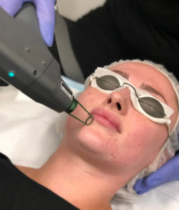 Laser Toning | Infinity Skin Clinic Mosman & Surry Hills, Sydney